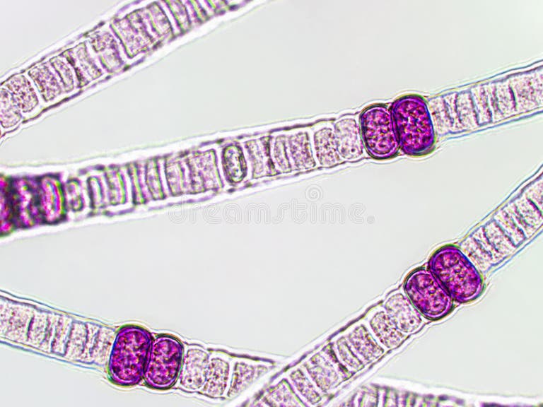 Probiotics, Lactic Acid Bacteria. Algae, Bacteria and Microorganisms ...