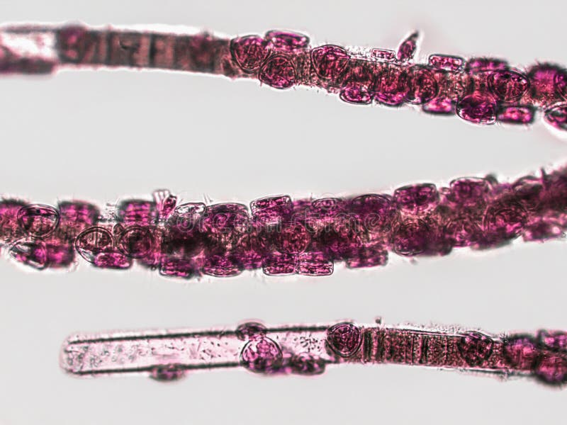 Probiotics, Lactic Acid Bacteria. Algae, Bacteria and Microorganisms ...