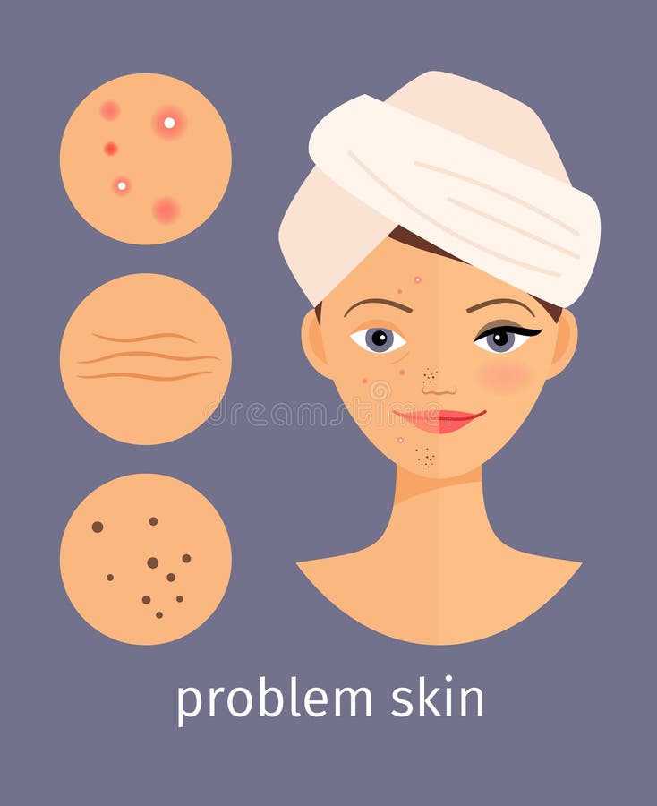 Problem Skin Care. Infographic Stock Vector - Illustration of lens ...