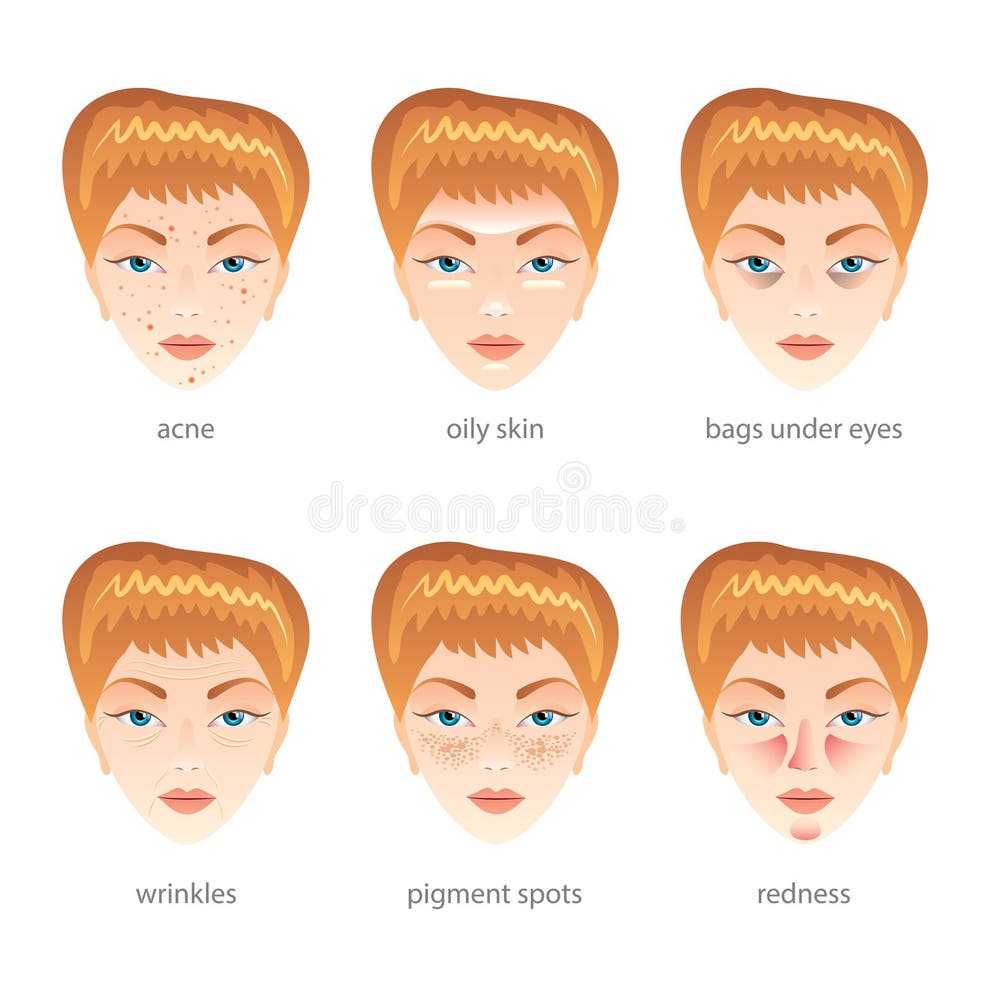 Face Skin Diseases Stock Illustrations – 309 Face Skin Diseases Stock ...