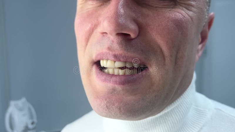Problem Teeth Yellow Spots Plaque False Teeth Need a Dentist a Man ...