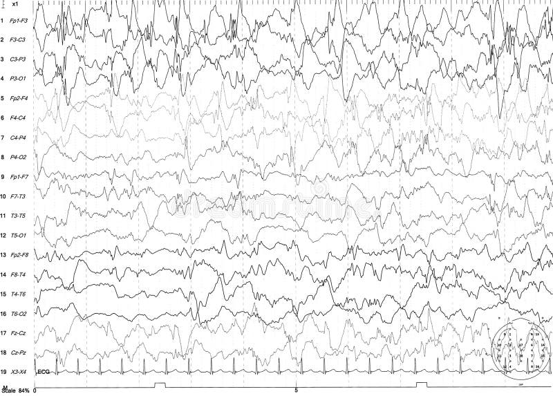 Brain Eeg Electroencephalogram Wave Stock Illustrations – 126 Brain Eeg ...