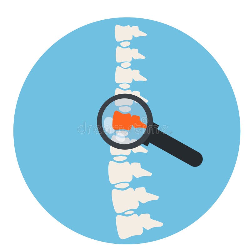 Problems with Spine. Posture Issues Stock Vector - Illustration of ...