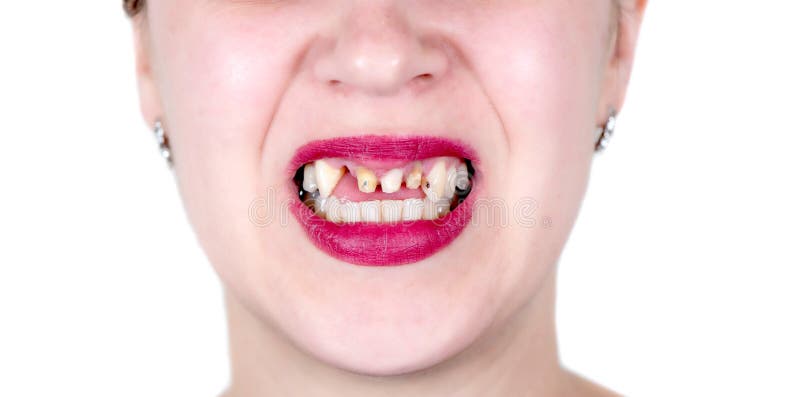 Front Teets Stock Photos - Free & Royalty-Free Stock Photos from Dreamstime