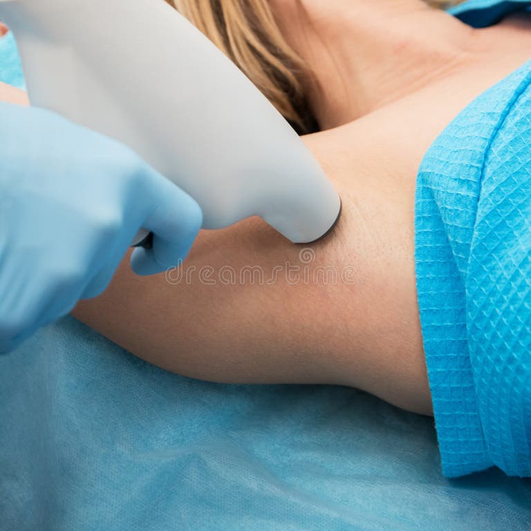 Procedure Against Hyperhidrosis Stock Image - Image of cosmetic ...