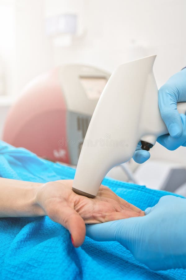 Procedure Against Hyperhidrosis Stock Image - Image of beauty, healthy ...