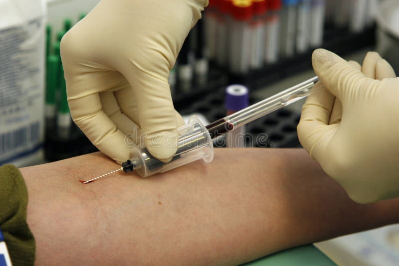 Suction Blood From Patient To Jackson-Pratt Drain Stock Photo - Image ...