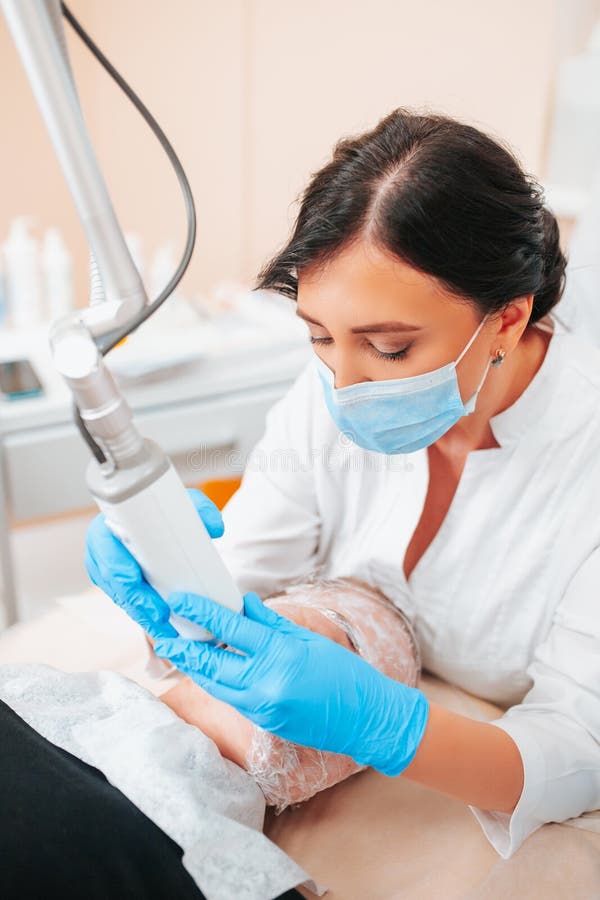 Laser Removal of Scars and Scars on the Skin Stock Image - Image of ...