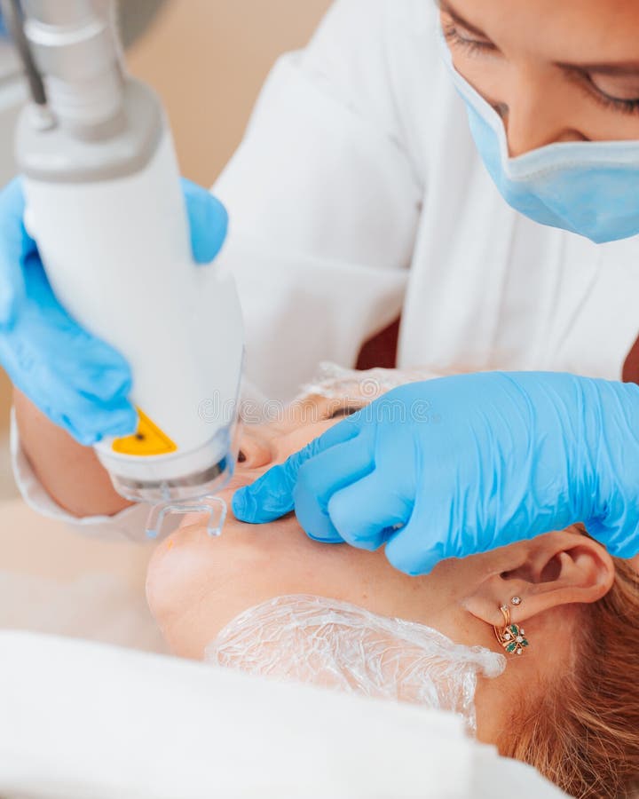 Laser Removal of Scars and Scars on the Skin Stock Photo - Image of ...