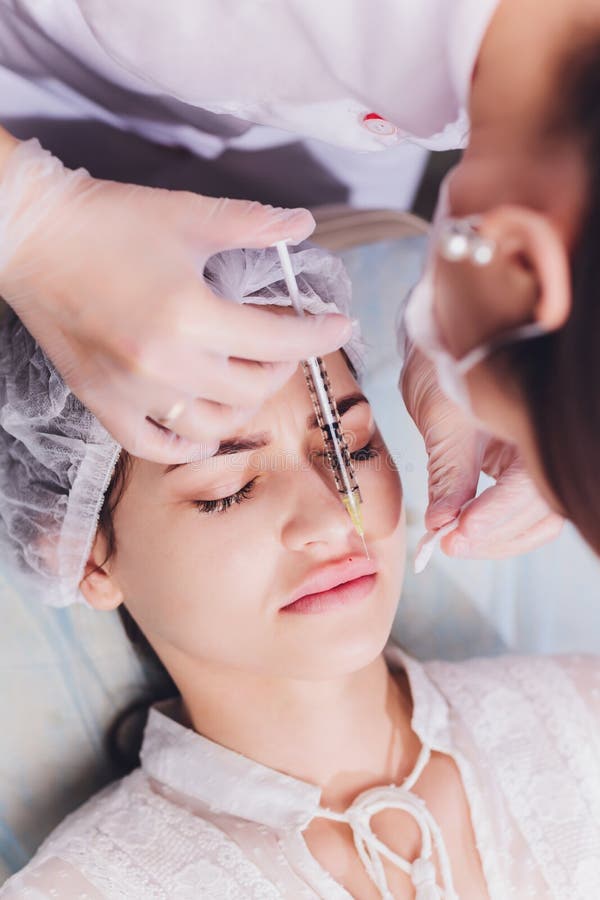 Procedure Of Lips Augmentation With Hyaluronic Acid Injection Stock Image Image Of Correction