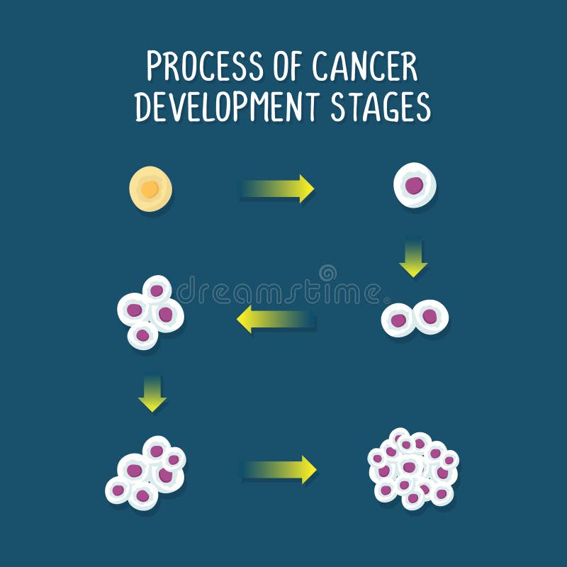 Process of Cancer Development Stages Illustration Isolated on Dark ...