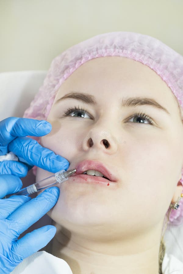 The Process of Cosmetic Surgery of Injection Stock Image - Image of ...