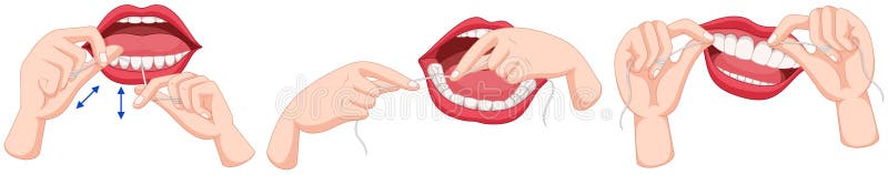 Flossing stock vector. Illustration of flossing, sulcus - 64662324