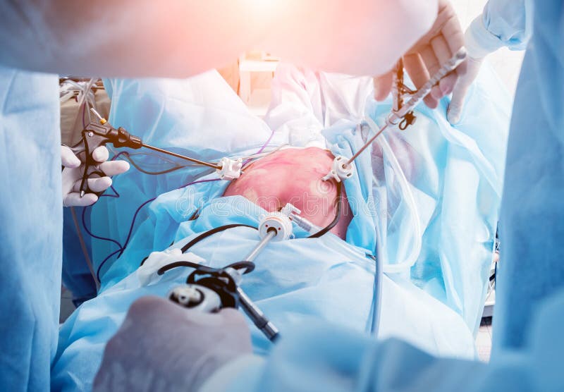 Process of Gynecological Surgery Operation Using Laparoscopic Equipment ...