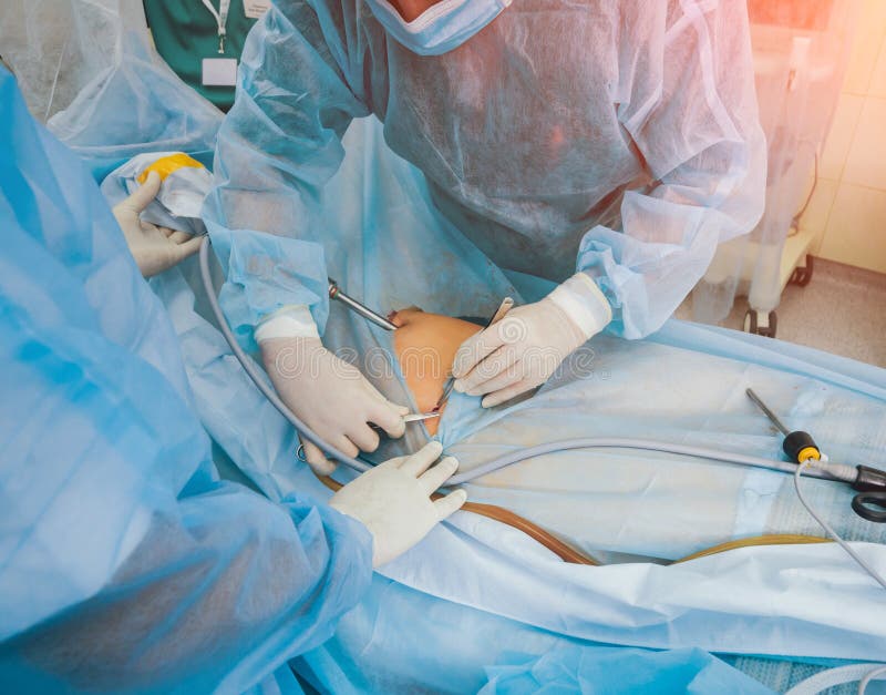 Process of Gynecological Surgery Operation Using Laparoscopic Equipment ...