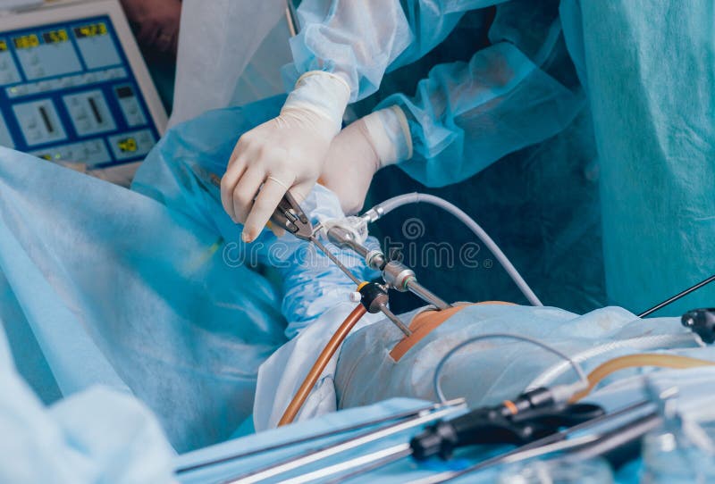 Process of Gynecological Surgery Operation Using Laparoscopic Equipment ...
