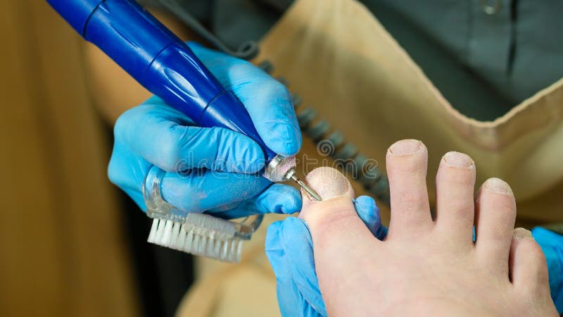 Lateral Sinuses Stock Photos - Free & Royalty-Free Stock Photos from ...