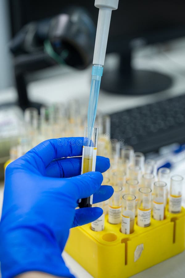 The Process of Laboratory Work in the Clinic in the Office Stock Photo ...