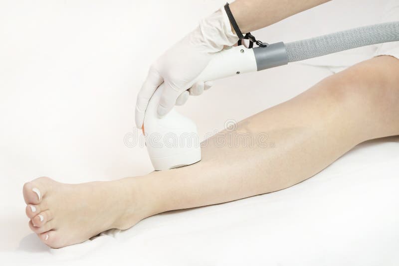 The Process of Laser Depilation of Female Limbs Stock Photo - Image of ...