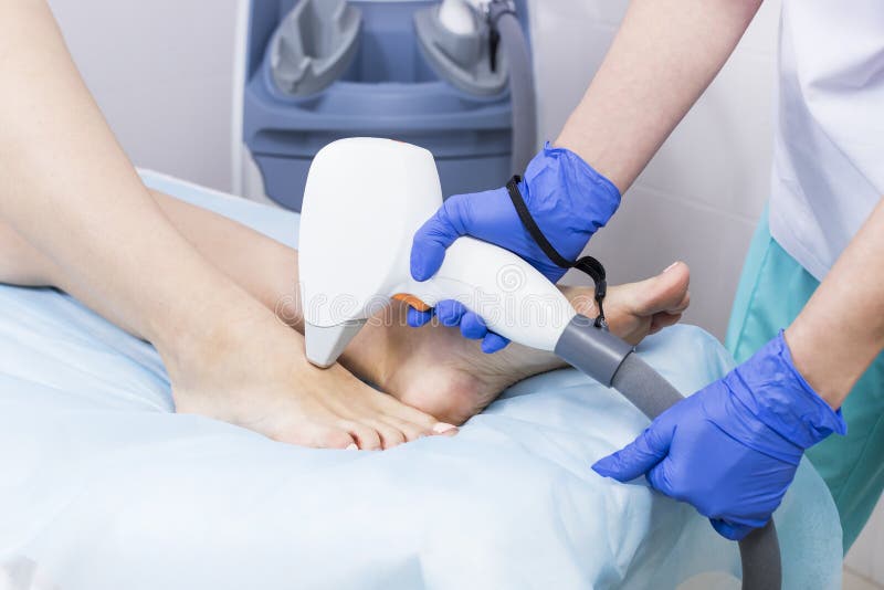 The Process of Laser Depilation of Female Limbs Stock Photo - Image of ...