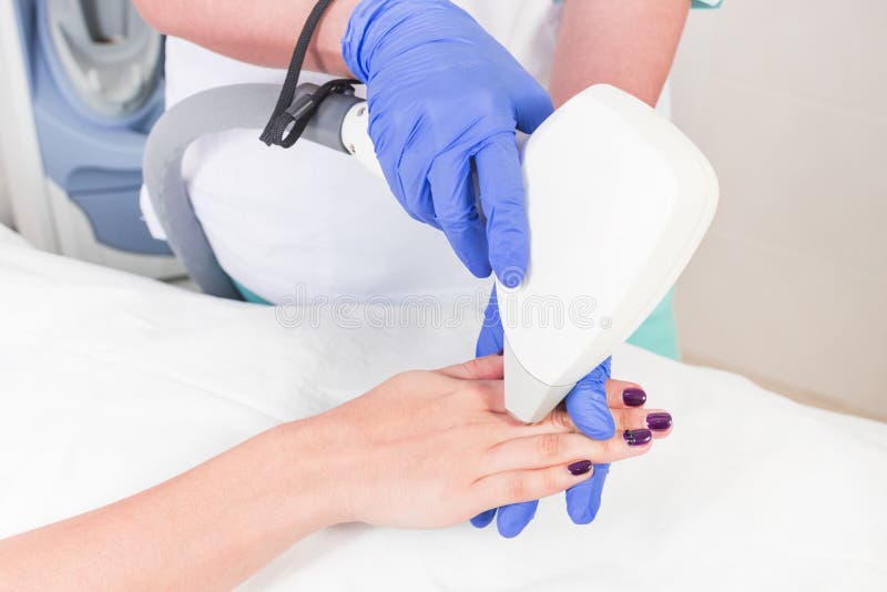 The Process of Laser Depilation of Female Limbs Stock Photo - Image of ...