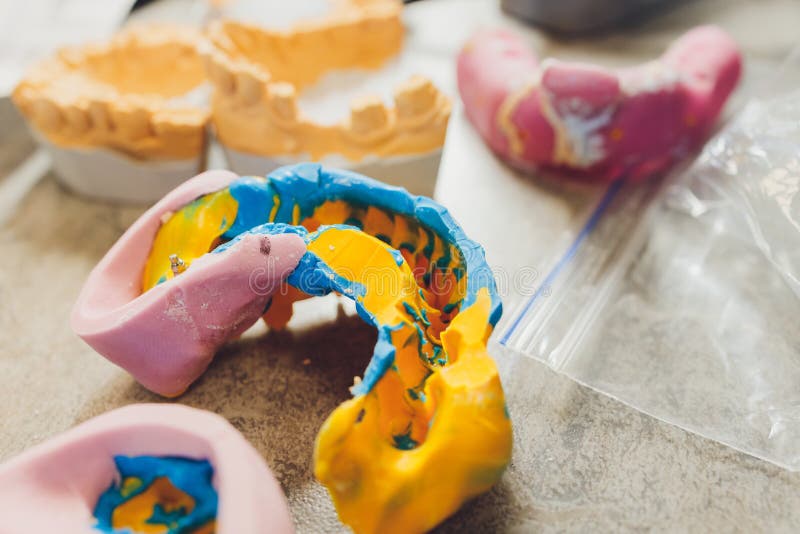 The Process of Making a Dental Prosthesis in a Dental Laboratory. Stock ...