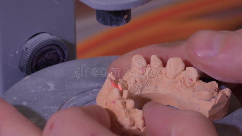 The Process of Making a Dental Prosthesis in a Dental Laboratory. Stock ...