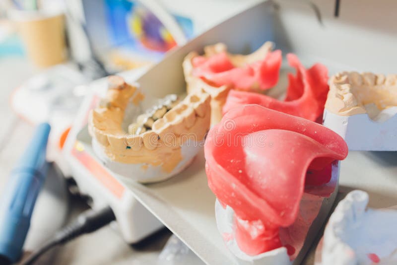 The Process of Making a Dental Prosthesis in a Dental Laboratory. Stock ...