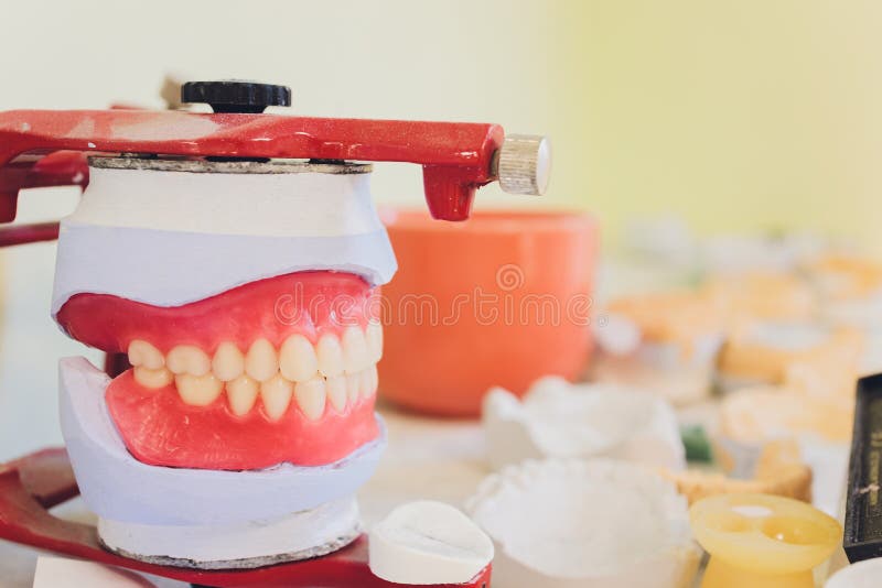 The Process of Making a Dental Prosthesis in a Dental Laboratory. Stock ...