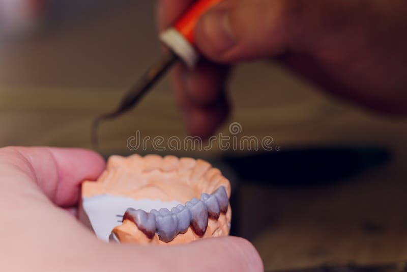 The Process of Making a Dental Prosthesis in a Dental Laboratory. Stock ...