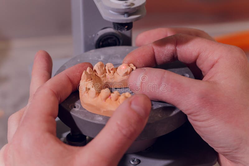 The Process of Making a Dental Prosthesis in a Dental Laboratory. Stock ...