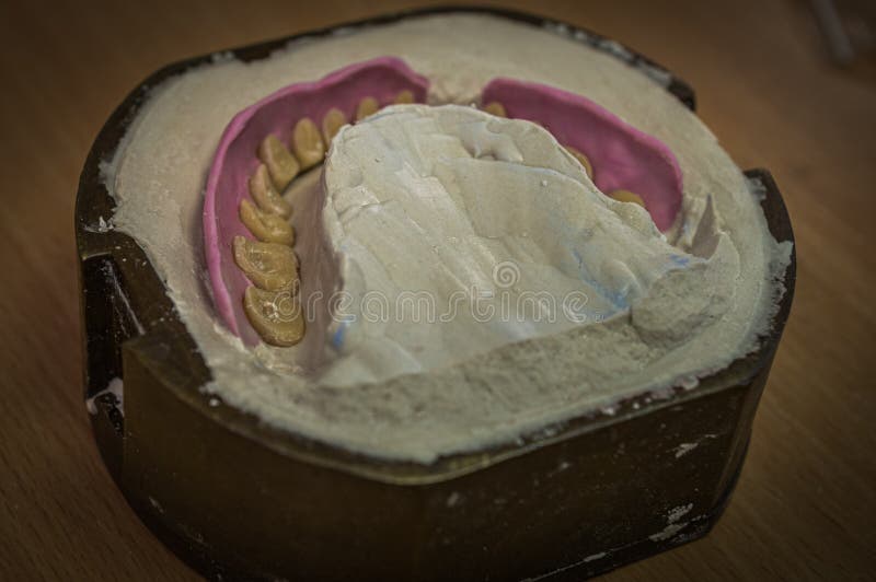 The Process of Making Human Artificial Teeth Stock Photo - Image of ...