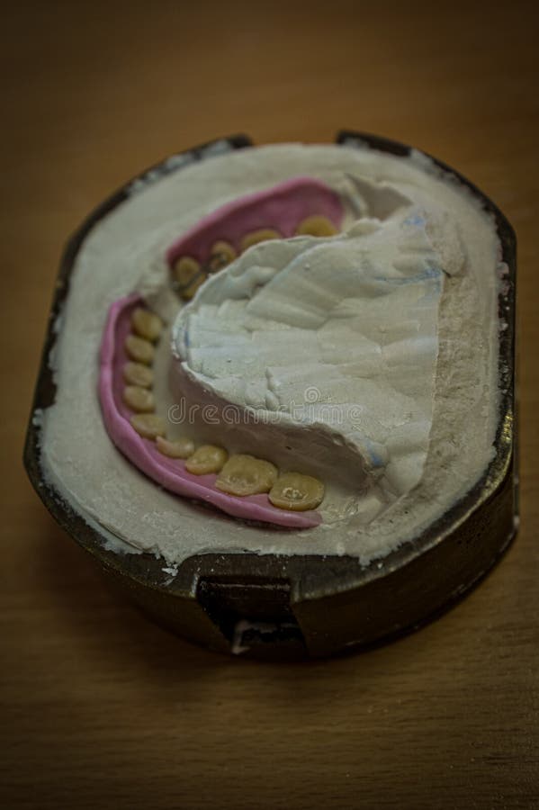 The Process of Making Human Artificial Teeth Stock Image - Image of ...