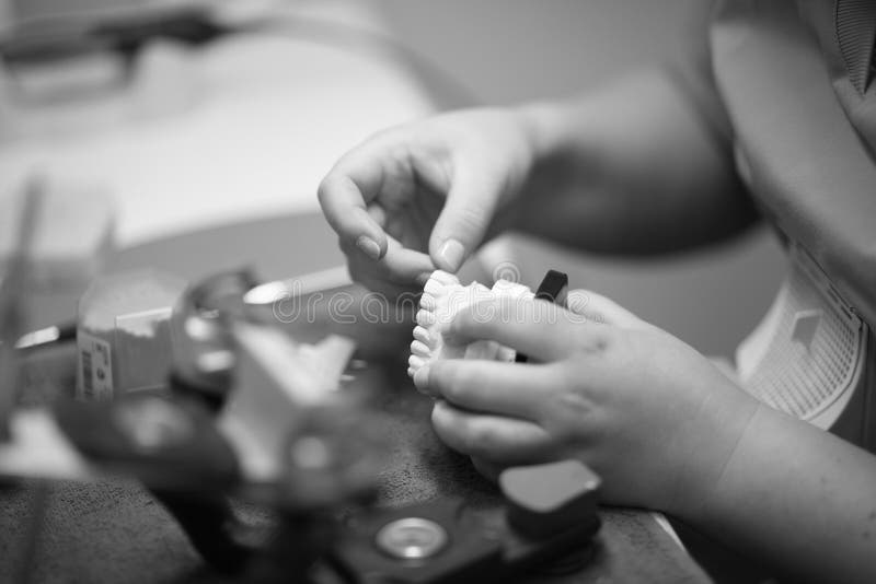 The Process of Manufacturing Dentures Stock Image - Image of clinical ...