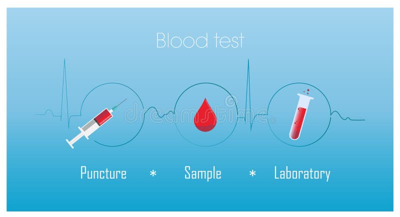 Process: Necessary Material, Sampling and Laboratory Analysis Stock ...