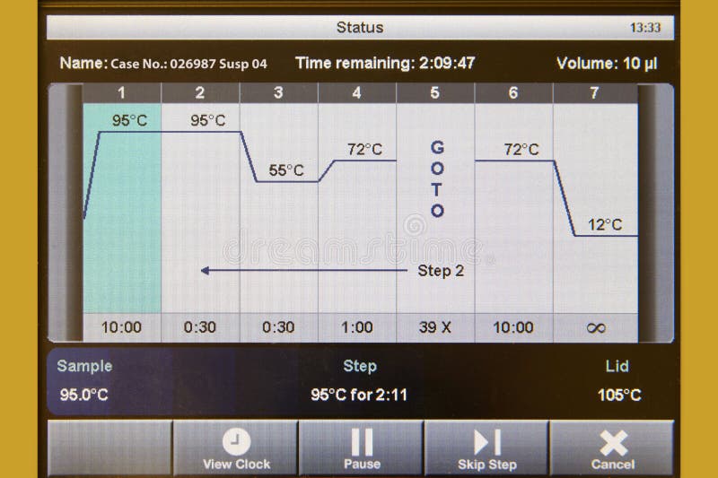 Process of PCR Reaction for DNA Testing Stock Photo - Image of ...