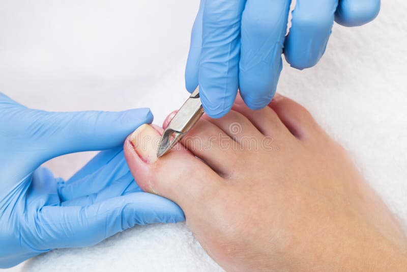 Process of pedicure stock image. Image of equipment, dermatology - 54836825