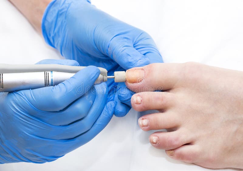 Process of pedicure stock image. Image of foot, pedicurist - 82520031