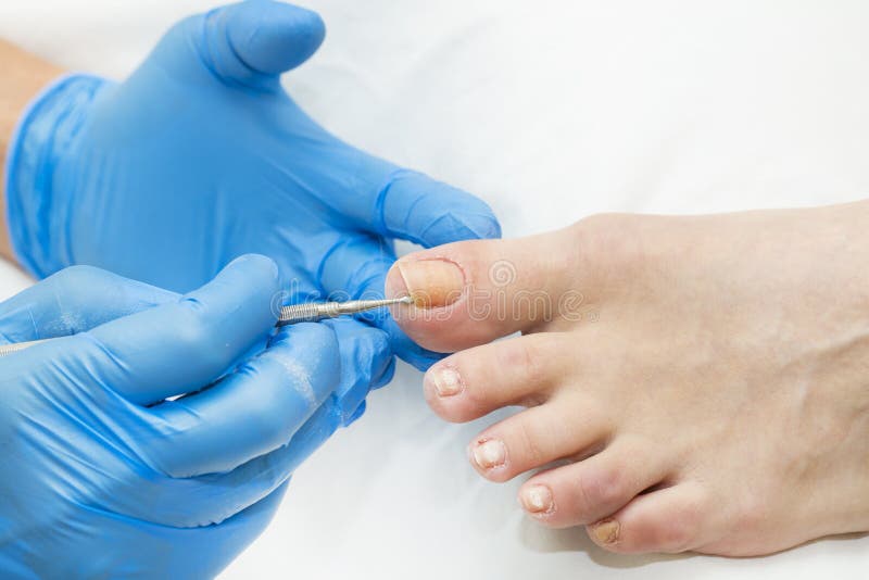 Process of pedicure stock photo. Image of beauty, caucasian - 82528268