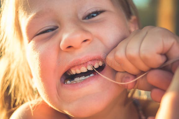 The Process of Removing a Baby Tooth Using a Thread Stock Photo - Image ...