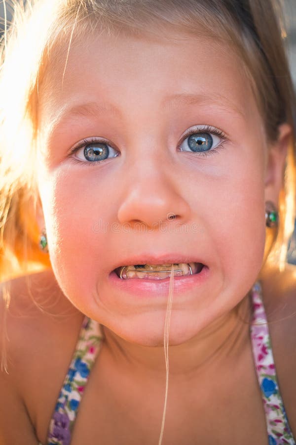 The Process of Removing a Baby Tooth Using a Thread Stock Photo - Image ...
