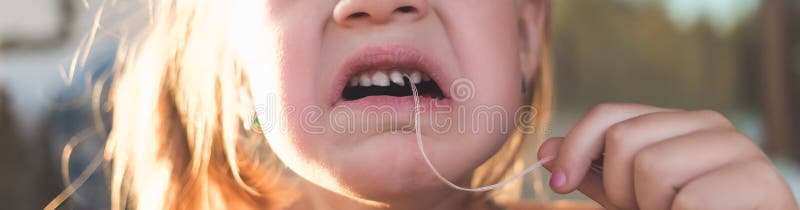 The Process of Removing a Baby Tooth Using a Thread Stock Photo - Image ...
