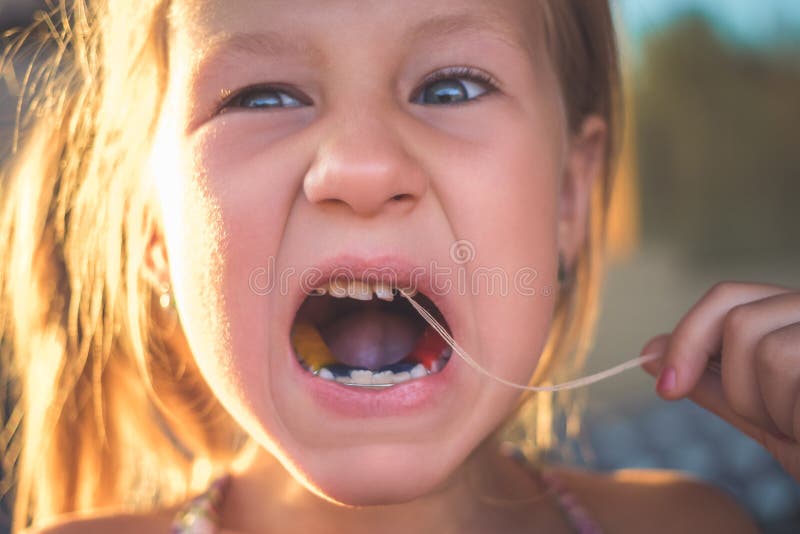 The Process of Removing a Baby Tooth Using a Thread Stock Photo - Image ...