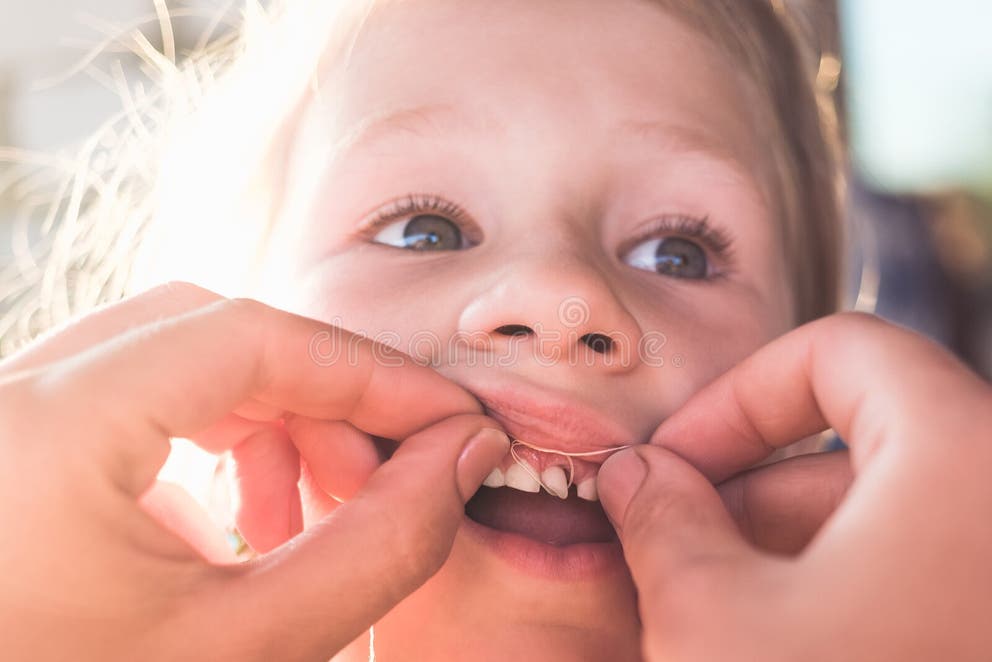 The Process of Removing a Baby Tooth Using a Thread Stock Image - Image ...