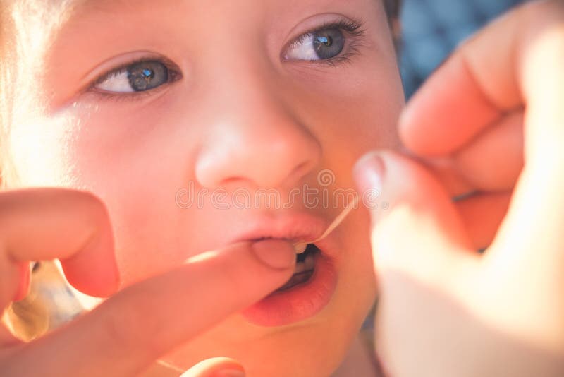 The Process of Removing a Baby Tooth Using a Thread Stock Photo - Image ...