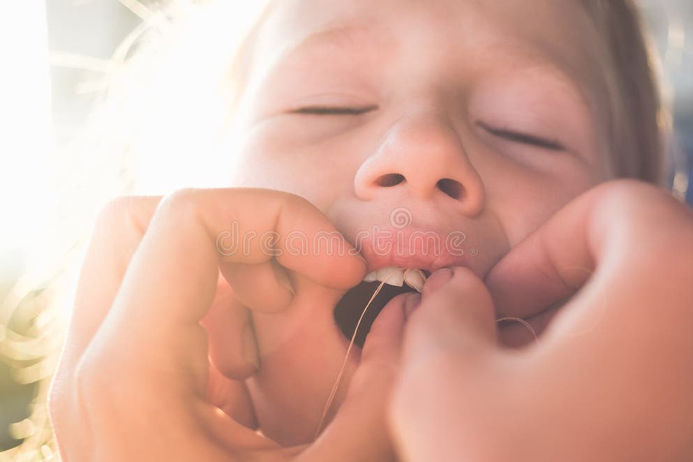 The Process of Removing a Baby Tooth Using a Thread Stock Image - Image ...