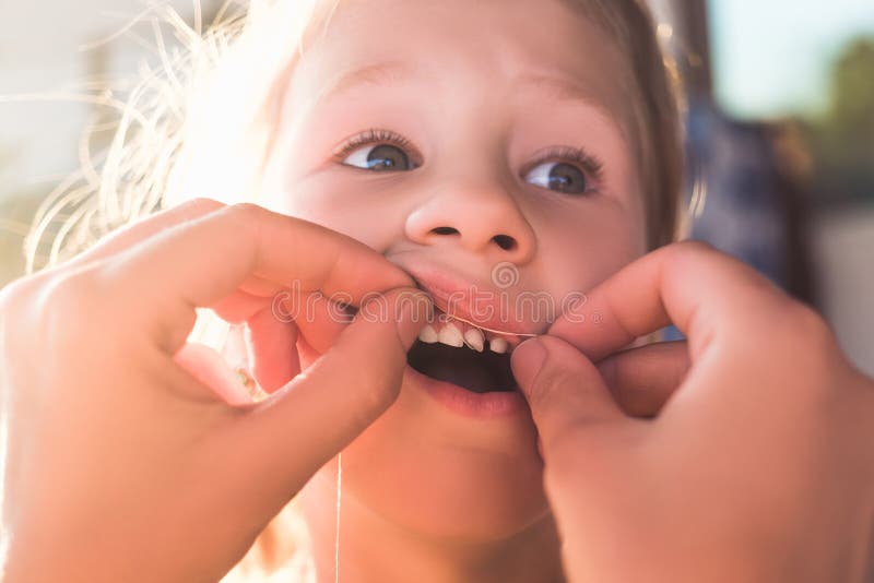 The Process of Removing a Baby Tooth Using a Thread Stock Photo - Image ...
