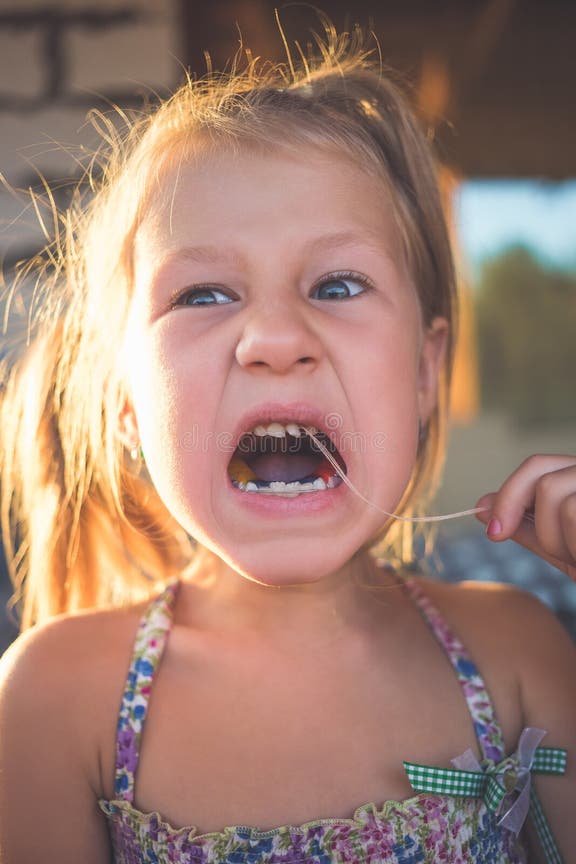 The Process of Removing a Baby Tooth Using a Thread Stock Photo - Image ...