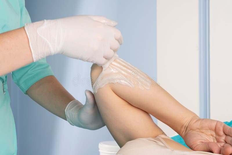 The Process of Sugaring the Arm in the Elbow Area. Beauty Salon Stock ...