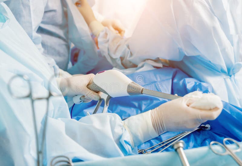 Process of Surgery Operation Using Laparoscopic Equipment. Stock Photo ...